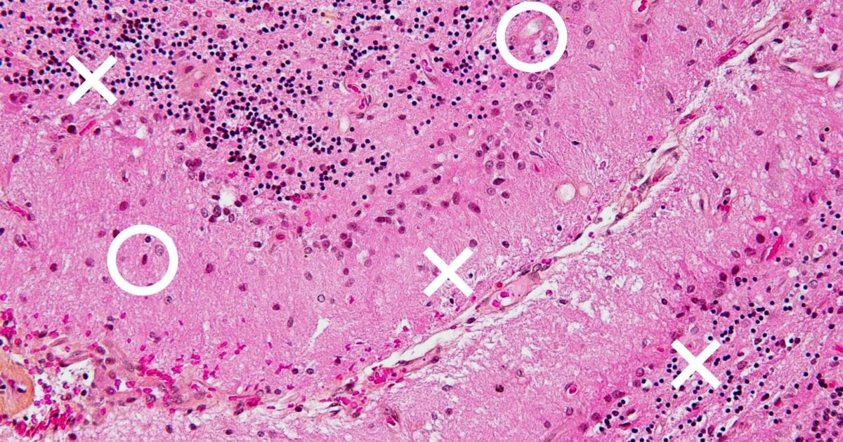 Segmentum Pathology research tool | Brightec